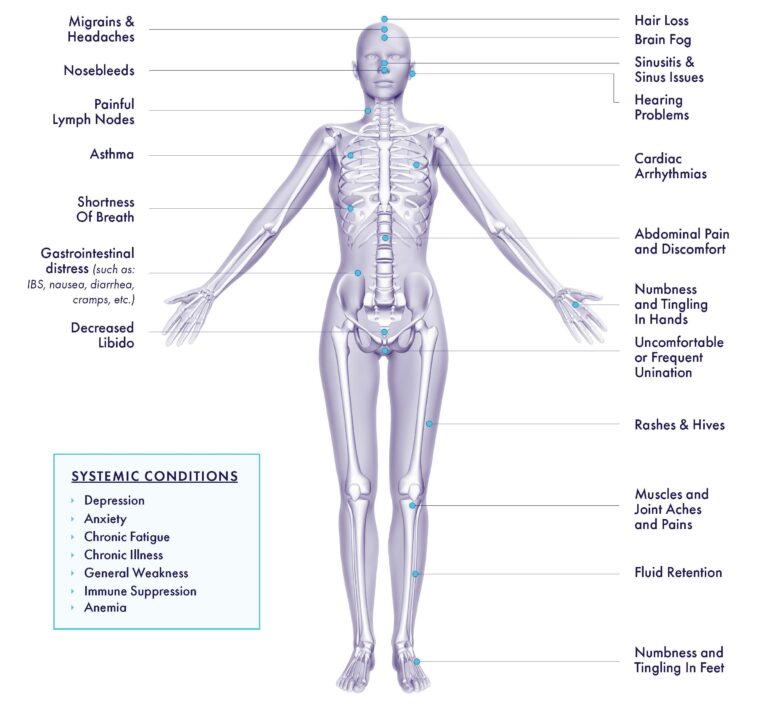 Mold Symptoms: 18 Signs to Look Out For and How to Get Help